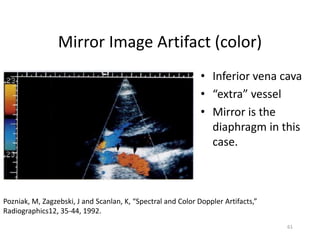 Reverberation Artifacts in ultrasound imaging | PDF