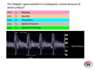 Reverberation Artifacts in ultrasound imaging | PDF