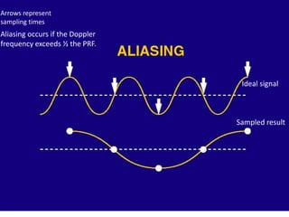 Reverberation Artifacts in ultrasound imaging | PDF