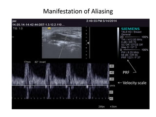 Reverberation Artifacts in ultrasound imaging | PDF