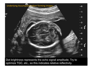 Reverberation Artifacts in ultrasound imaging | PDF