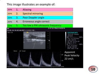 Reverberation Artifacts in ultrasound imaging | PDF