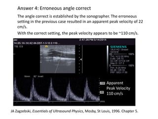 Reverberation Artifacts in ultrasound imaging | PDF