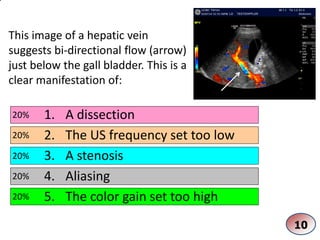 Reverberation Artifacts in ultrasound imaging | PDF