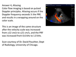 Reverberation Artifacts in ultrasound imaging | PDF