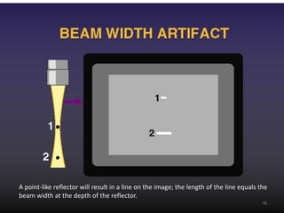 Reverberation Artifacts in ultrasound imaging | PDF