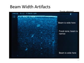 Reverberation Artifacts in ultrasound imaging | PDF