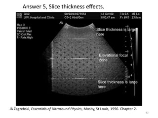 Reverberation Artifacts in ultrasound imaging | PDF