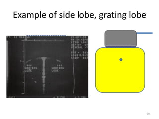 Reverberation Artifacts in ultrasound imaging | PDF