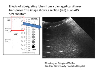 Reverberation Artifacts in ultrasound imaging | PDF