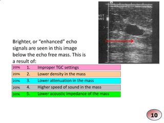 Reverberation Artifacts in ultrasound imaging | PDF