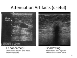Reverberation Artifacts in ultrasound imaging | PDF