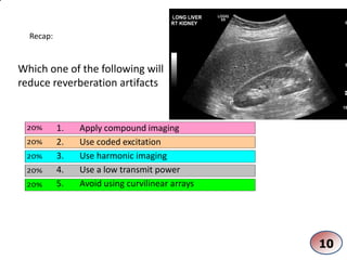 Reverberation Artifacts in ultrasound imaging | PDF