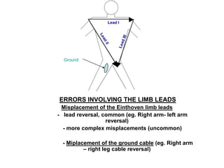 Reversal Limb Leads | PPT