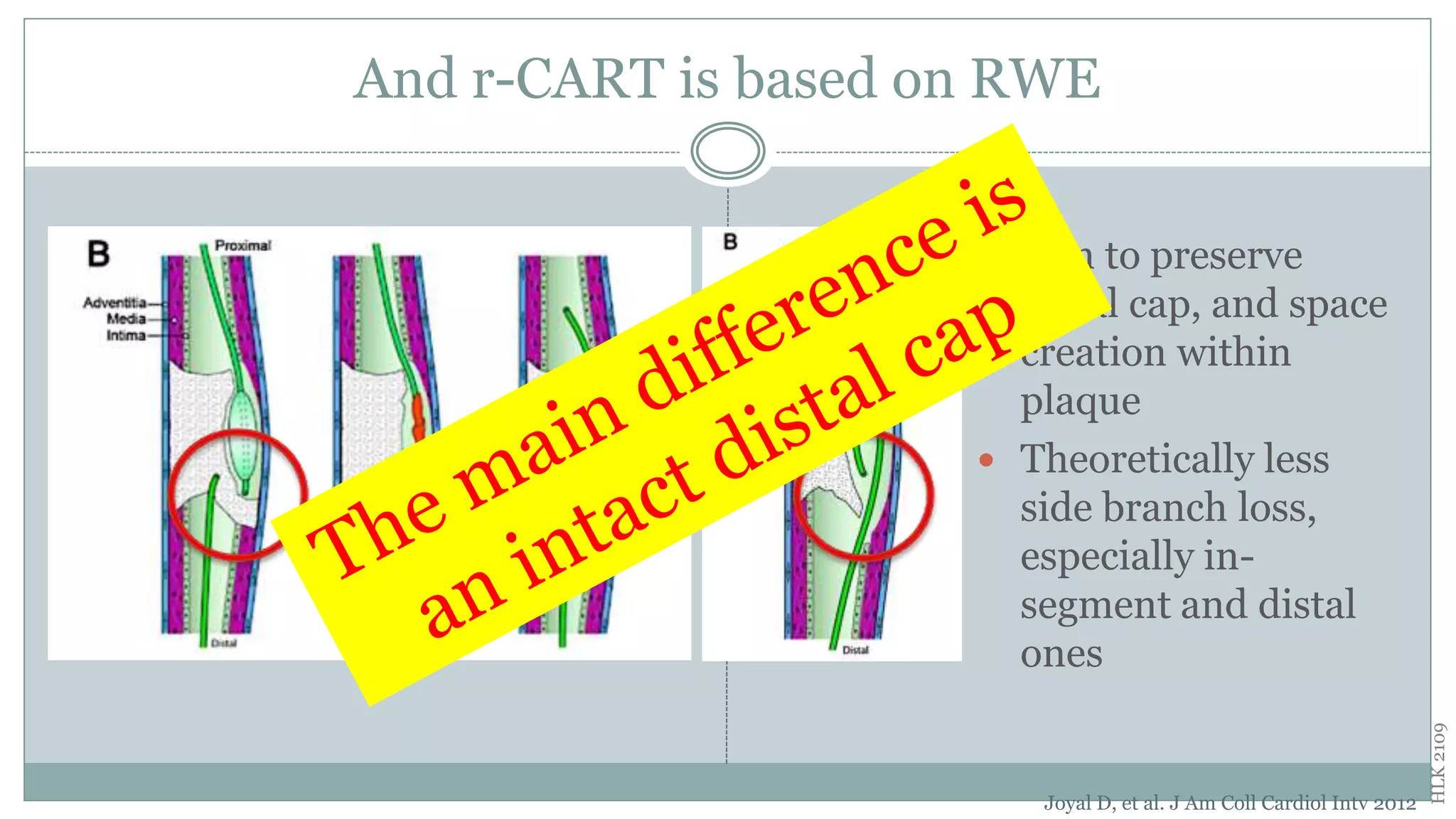 Debate: Is there a difference between RDR and reverse CART? – Yes | PPTX