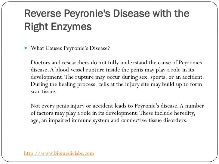 What Is Reverse Peyronies Disease