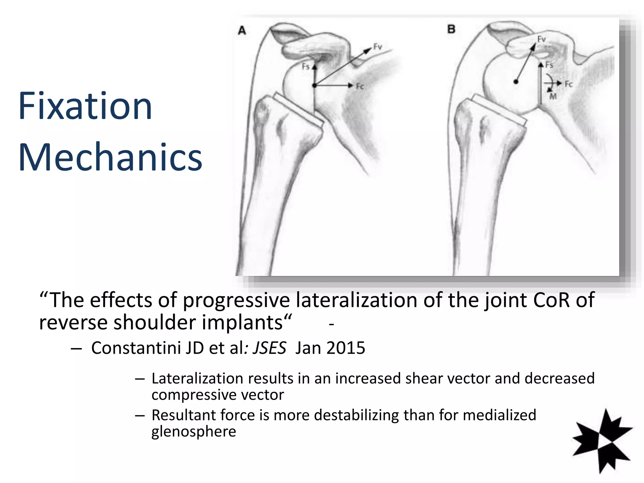 Reverse shoulder biomechanics | PPTX