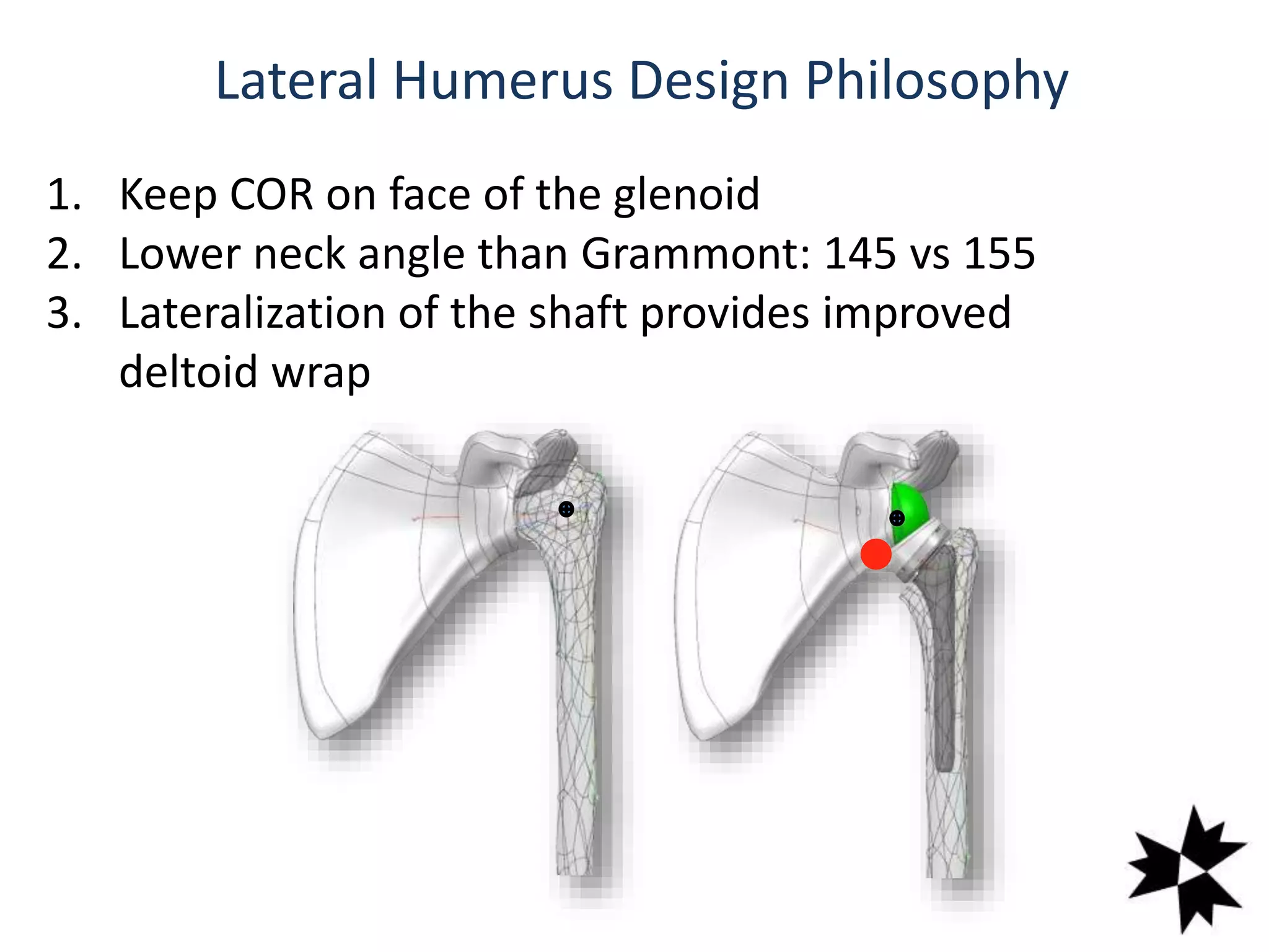 Reverse shoulder biomechanics | PPTX