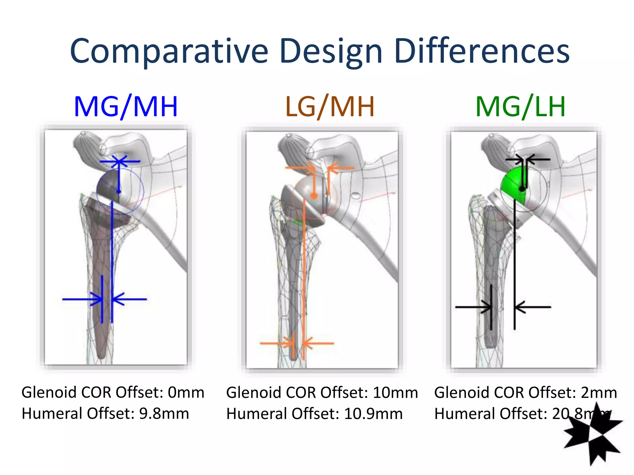 Reverse shoulder biomechanics | PPTX