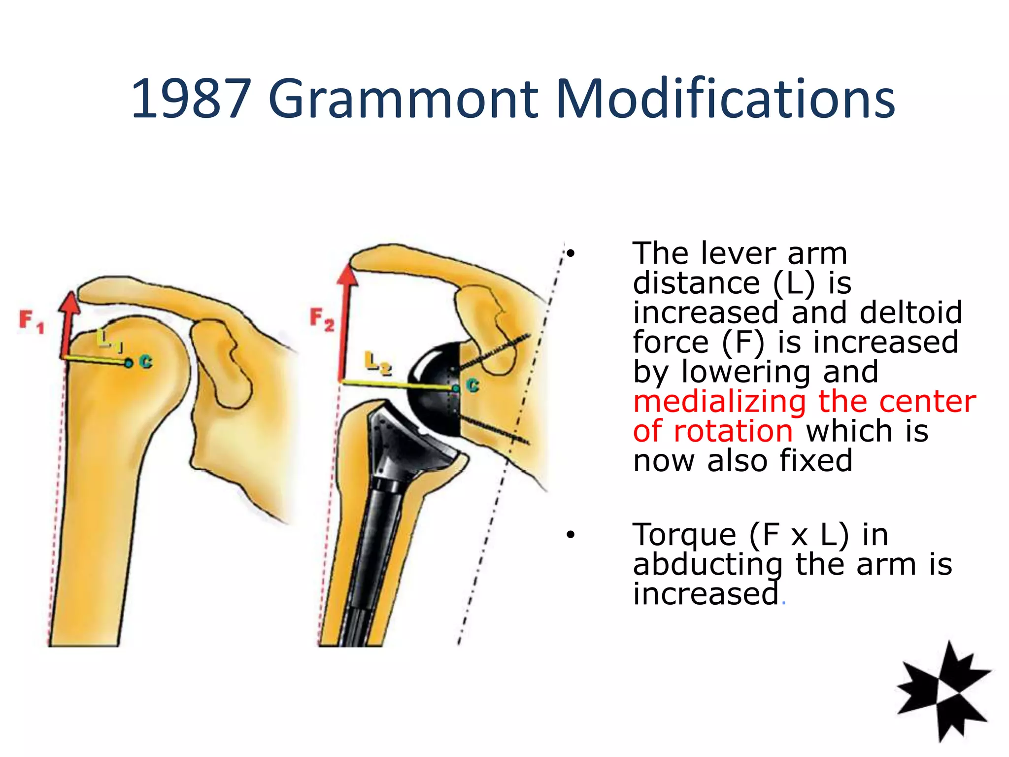 Reverse shoulder biomechanics | PPTX