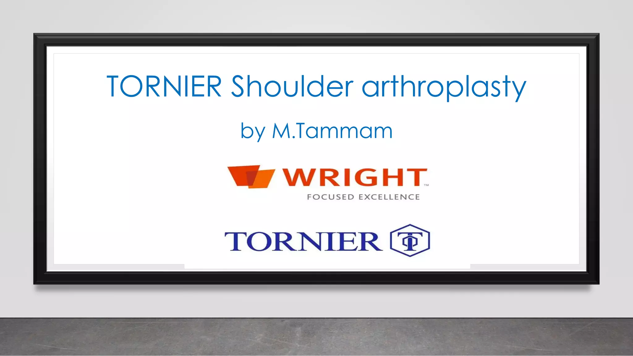 reverse Shoulder presentation.pdf