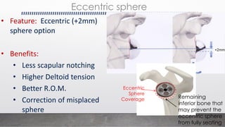 reverse Shoulder presentation.pdf