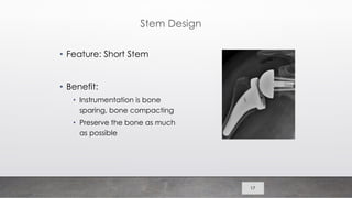 reverse Shoulder presentation.pdf