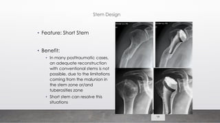 reverse Shoulder presentation.pdf