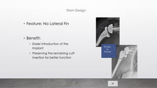 reverse Shoulder presentation.pdf