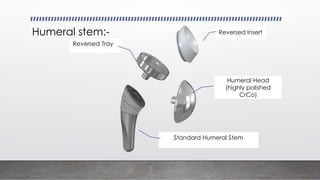 reverse Shoulder presentation.pdf