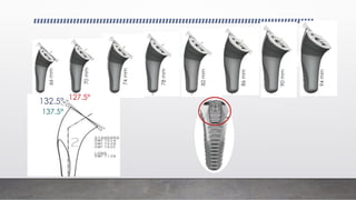 reverse Shoulder presentation.pdf