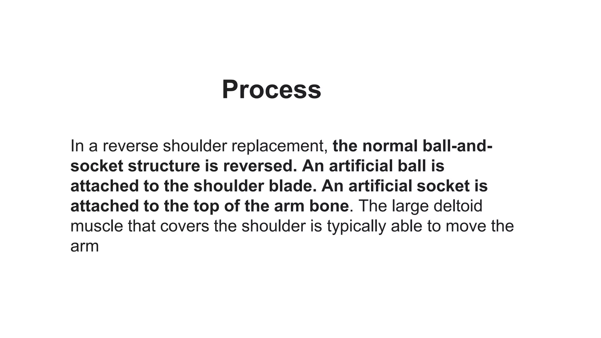 Reverse Shoulder Replacement.pptx