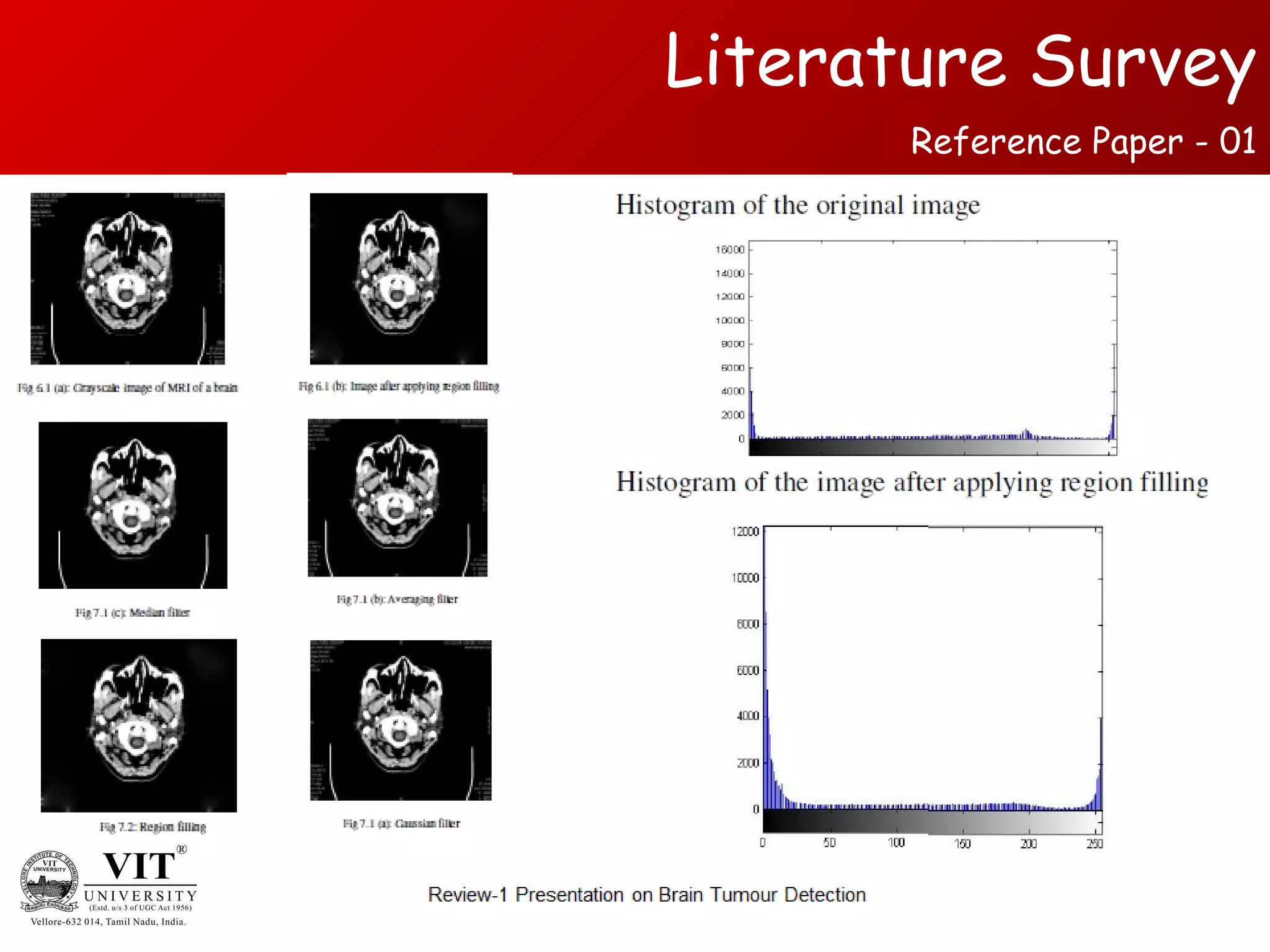 Brain Tumor Detection By Scanning Mri Images Using Filtering