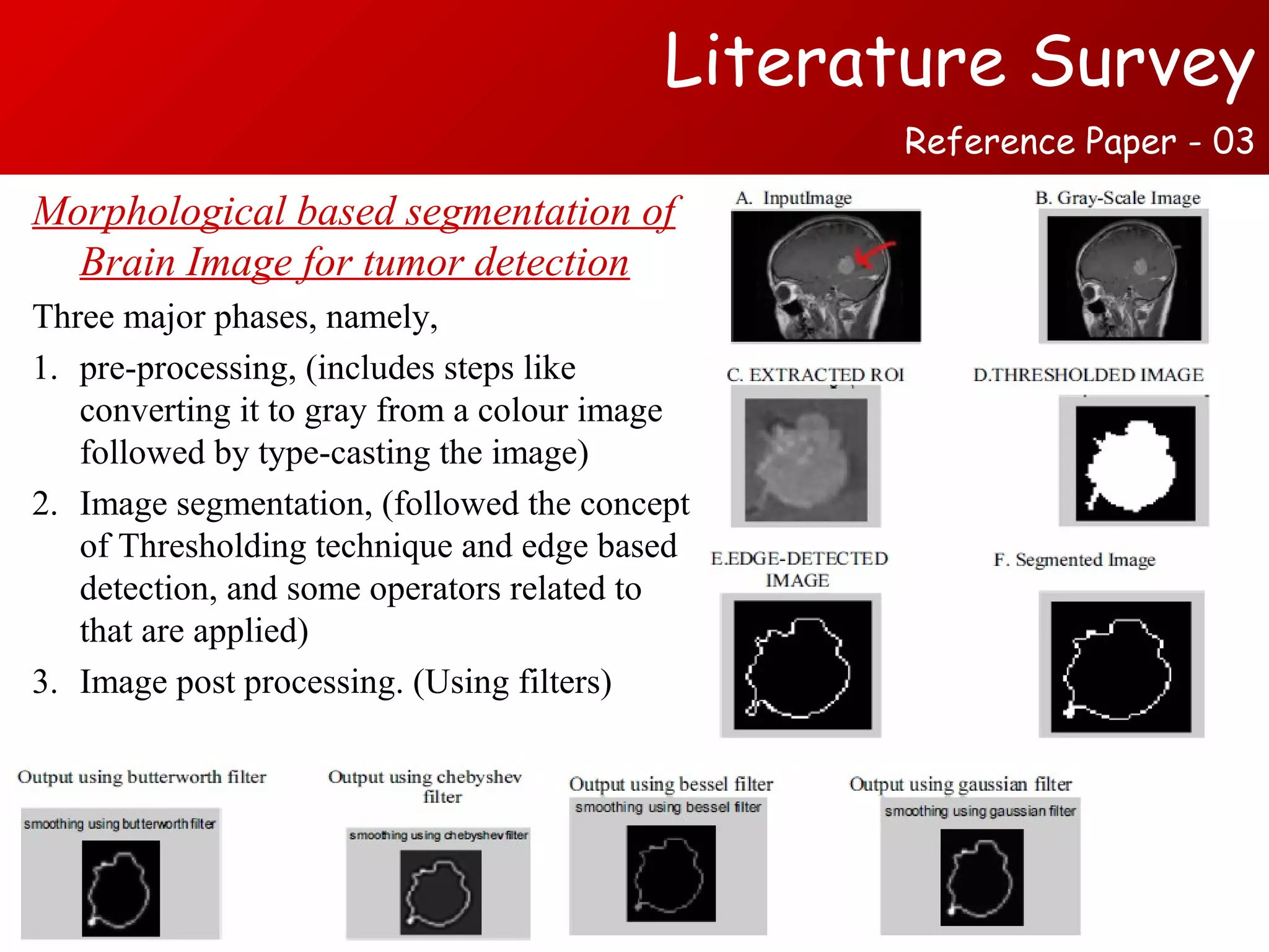 Brain Tumor Detection By Scanning Mri Images Using Filtering