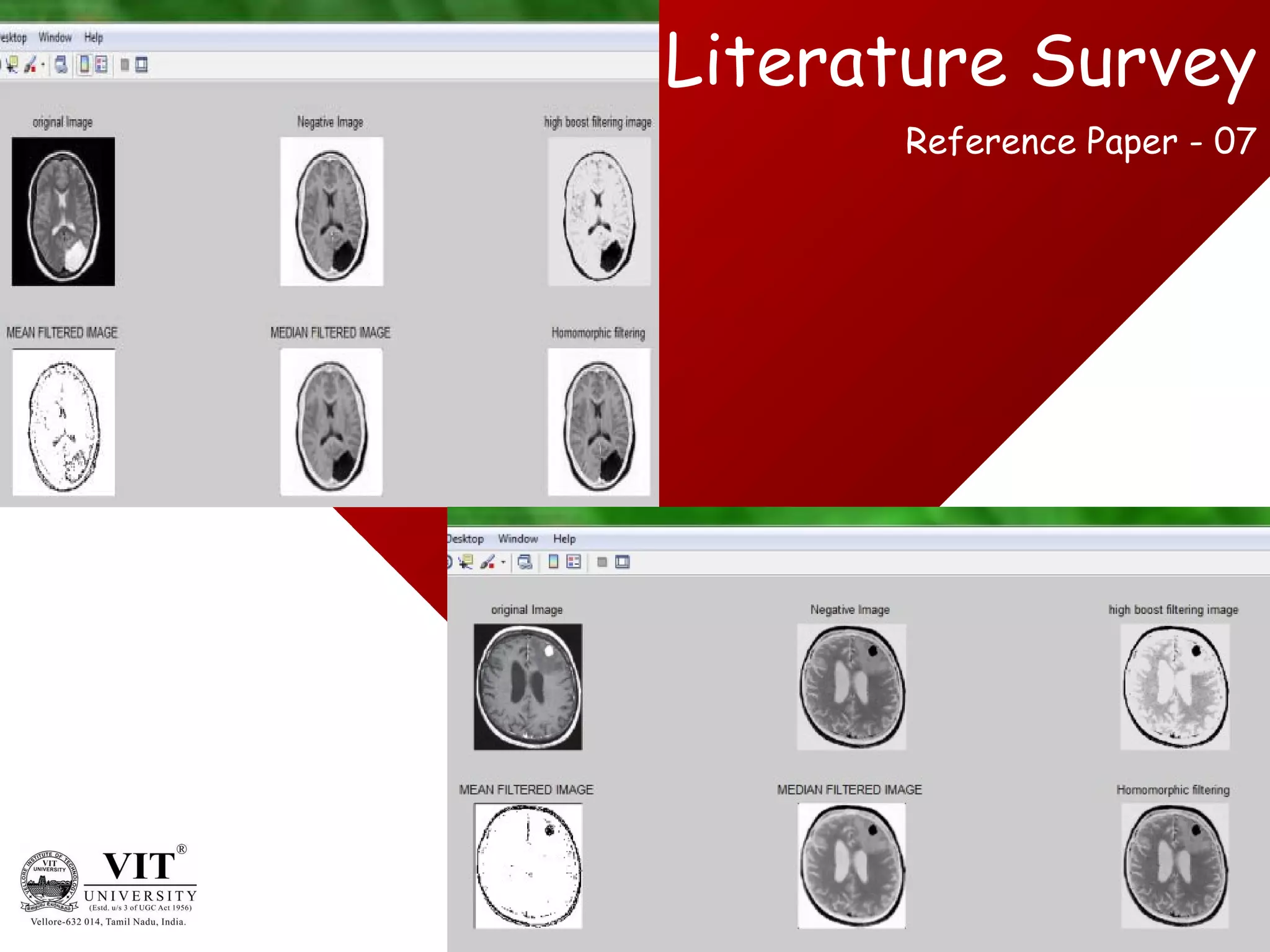 Brain Tumor Detection By Scanning Mri Images Using Filtering
