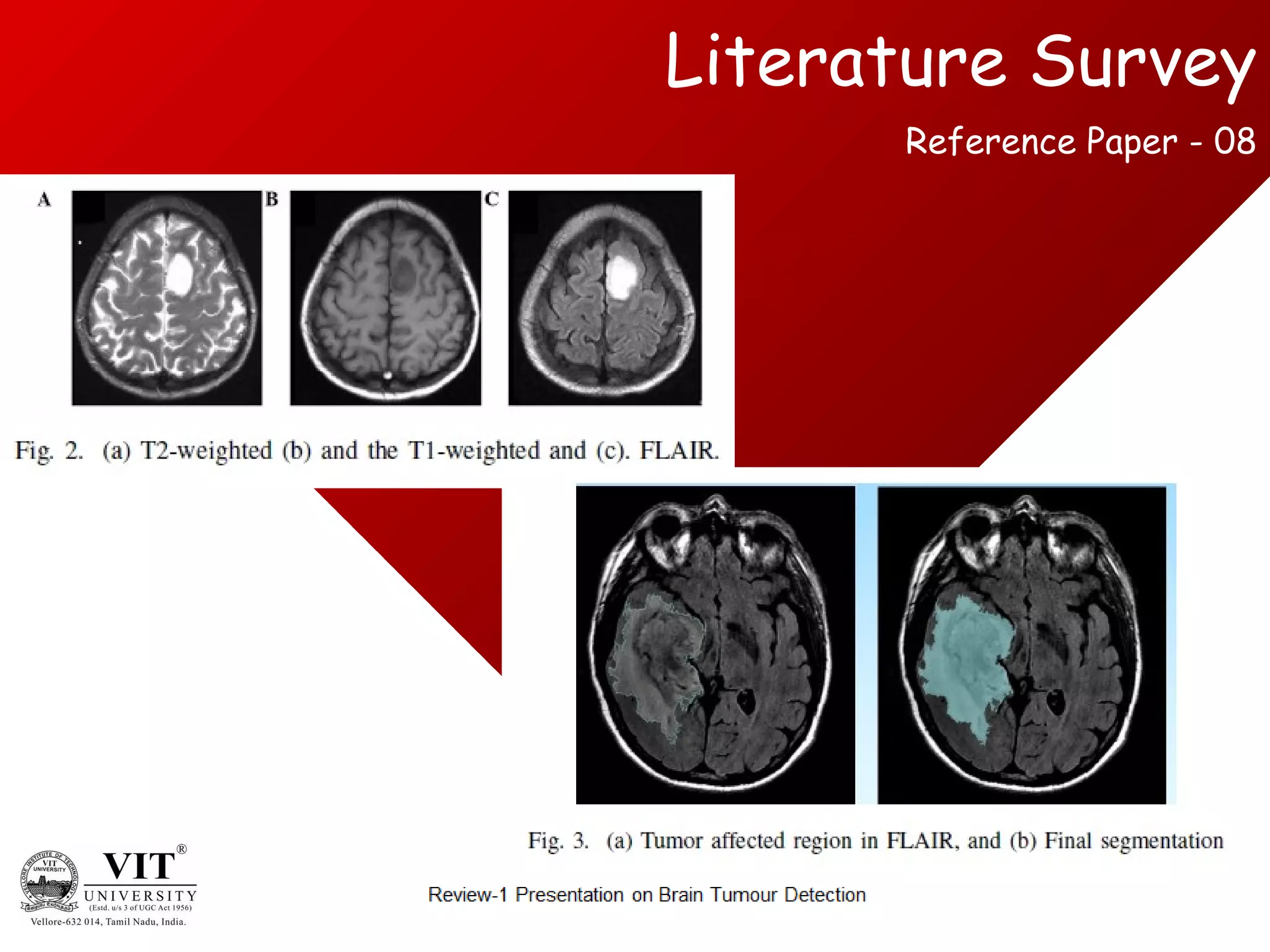 Brain Tumor Detection By Scanning Mri Images Using Filtering
