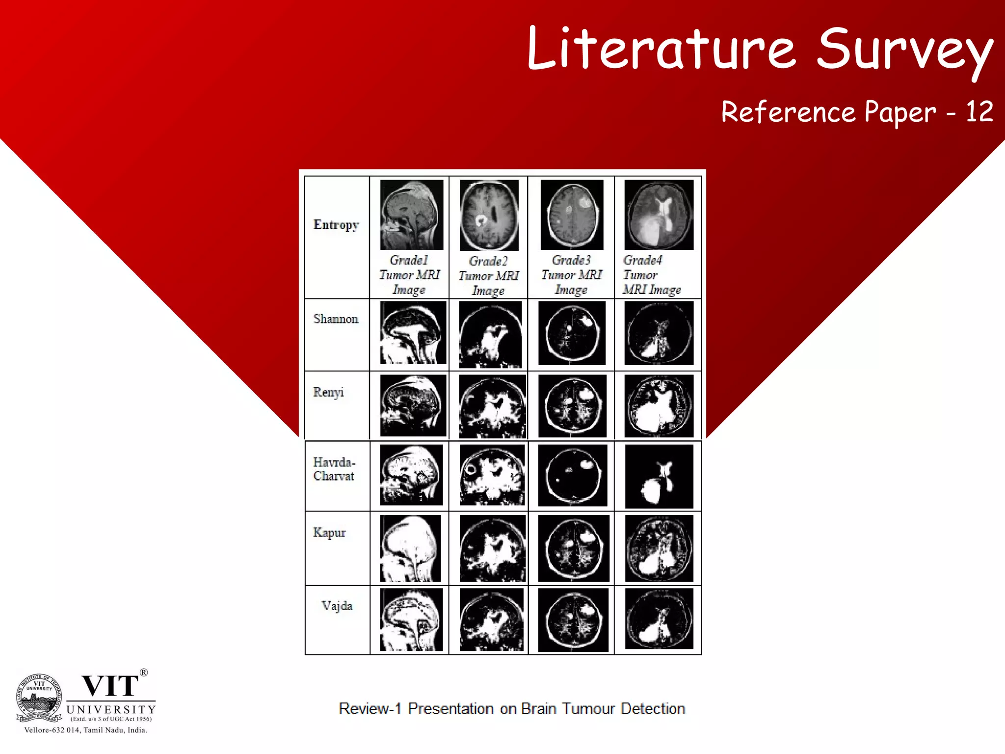 Brain Tumor Detection By Scanning Mri Images Using Filtering