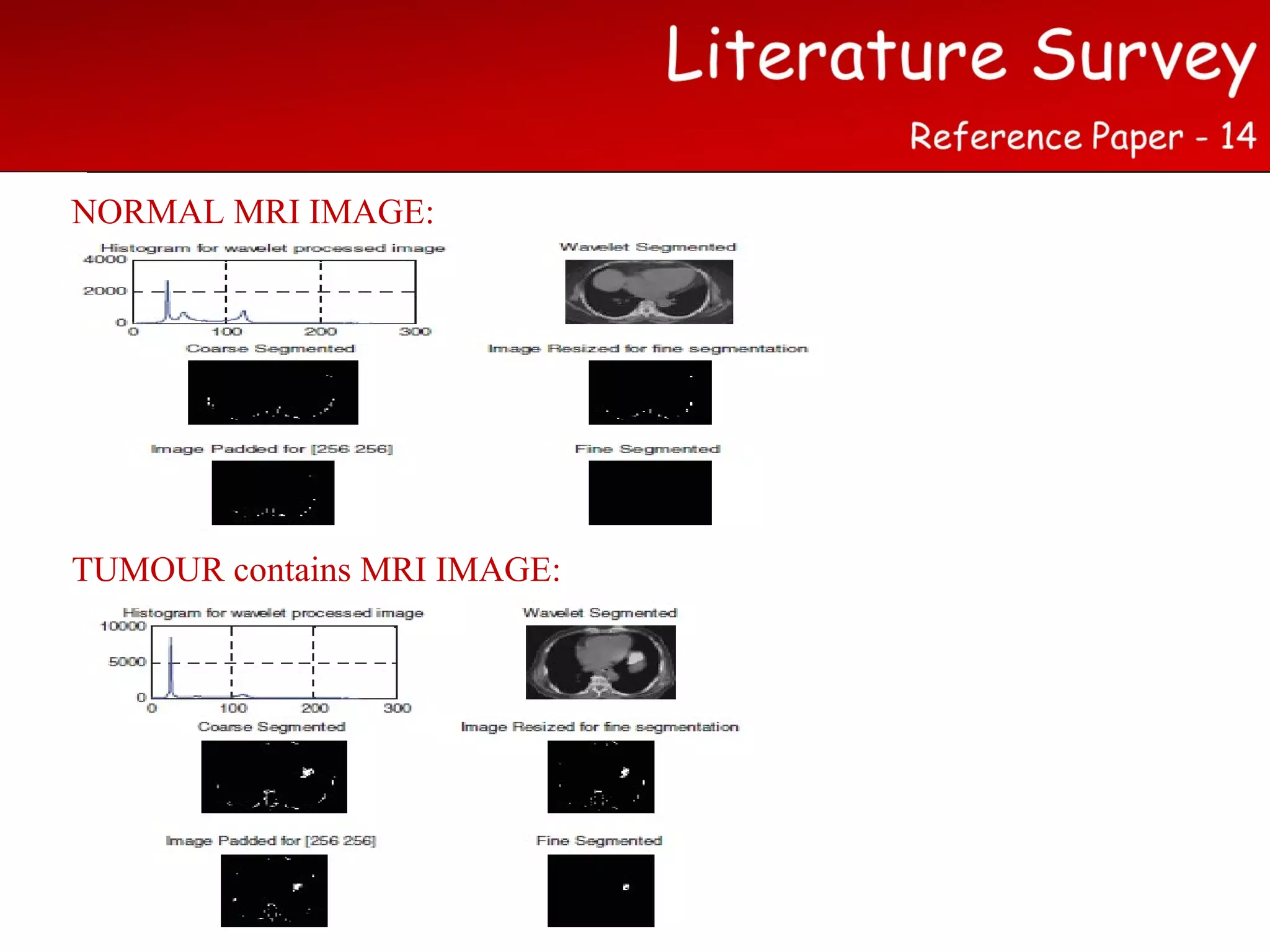 Brain Tumor Detection By Scanning Mri Images Using Filtering