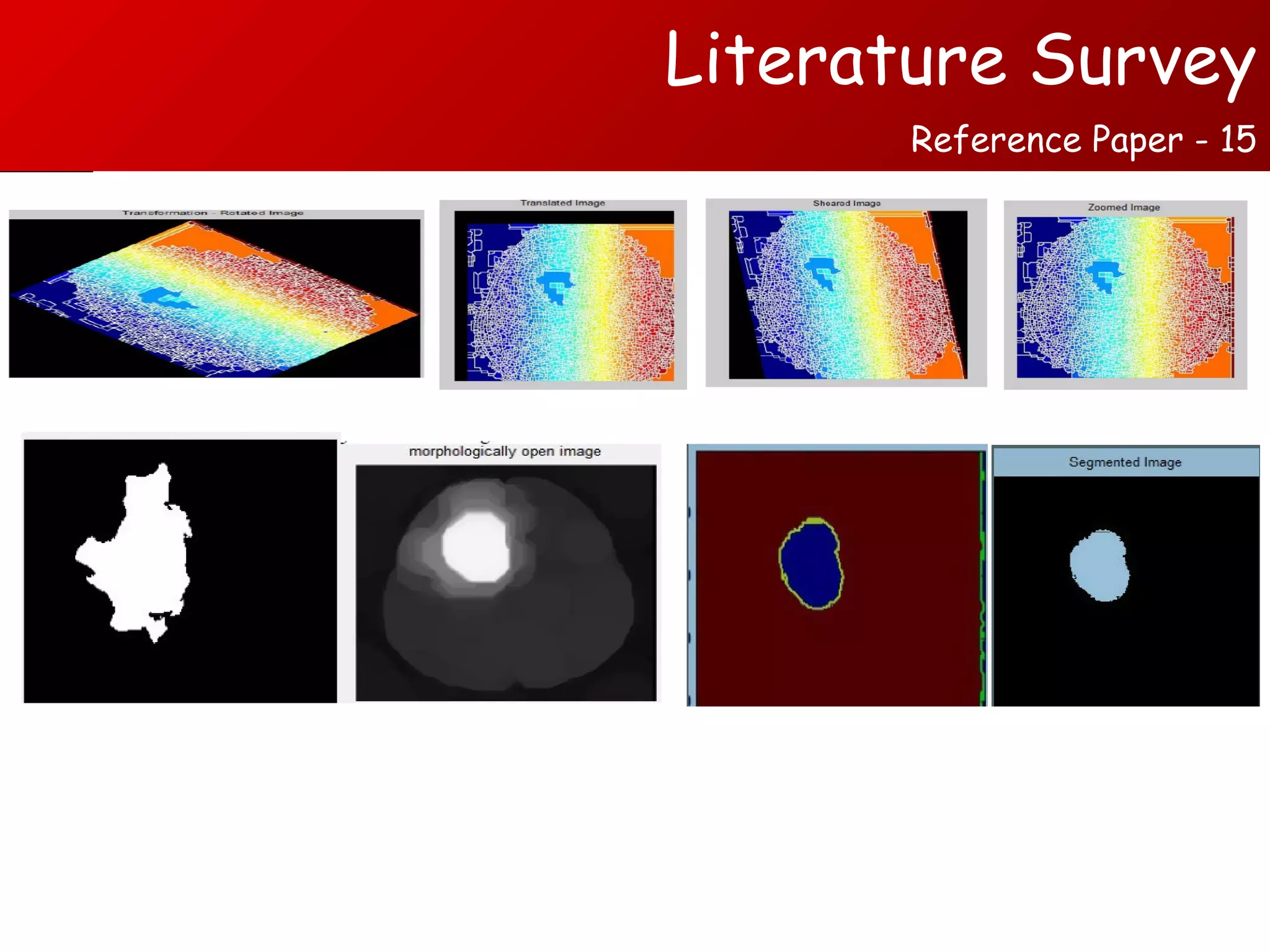 Brain Tumor Detection By Scanning Mri Images Using Filtering