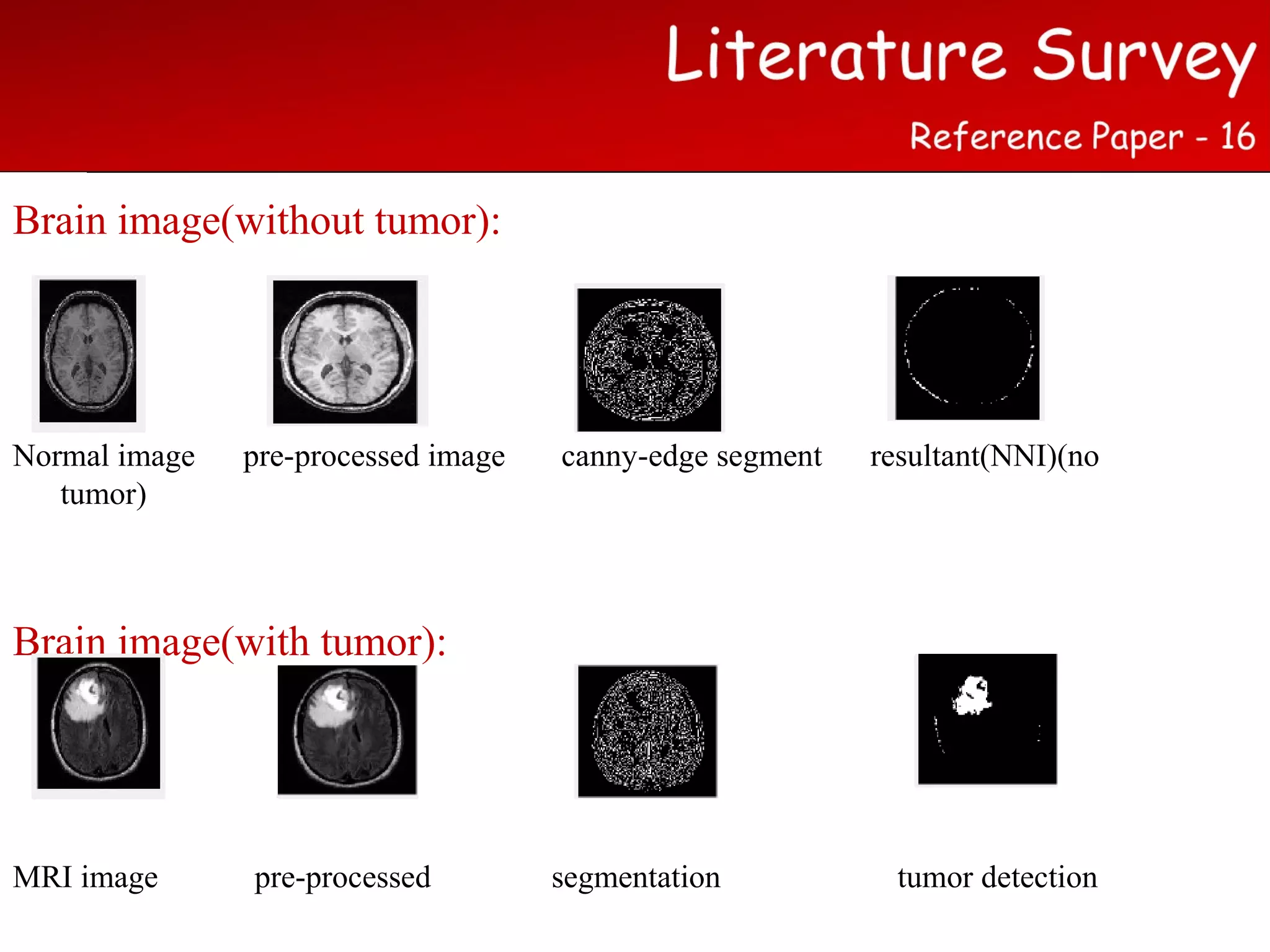 Brain Tumor Detection By Scanning Mri Images Using Filtering