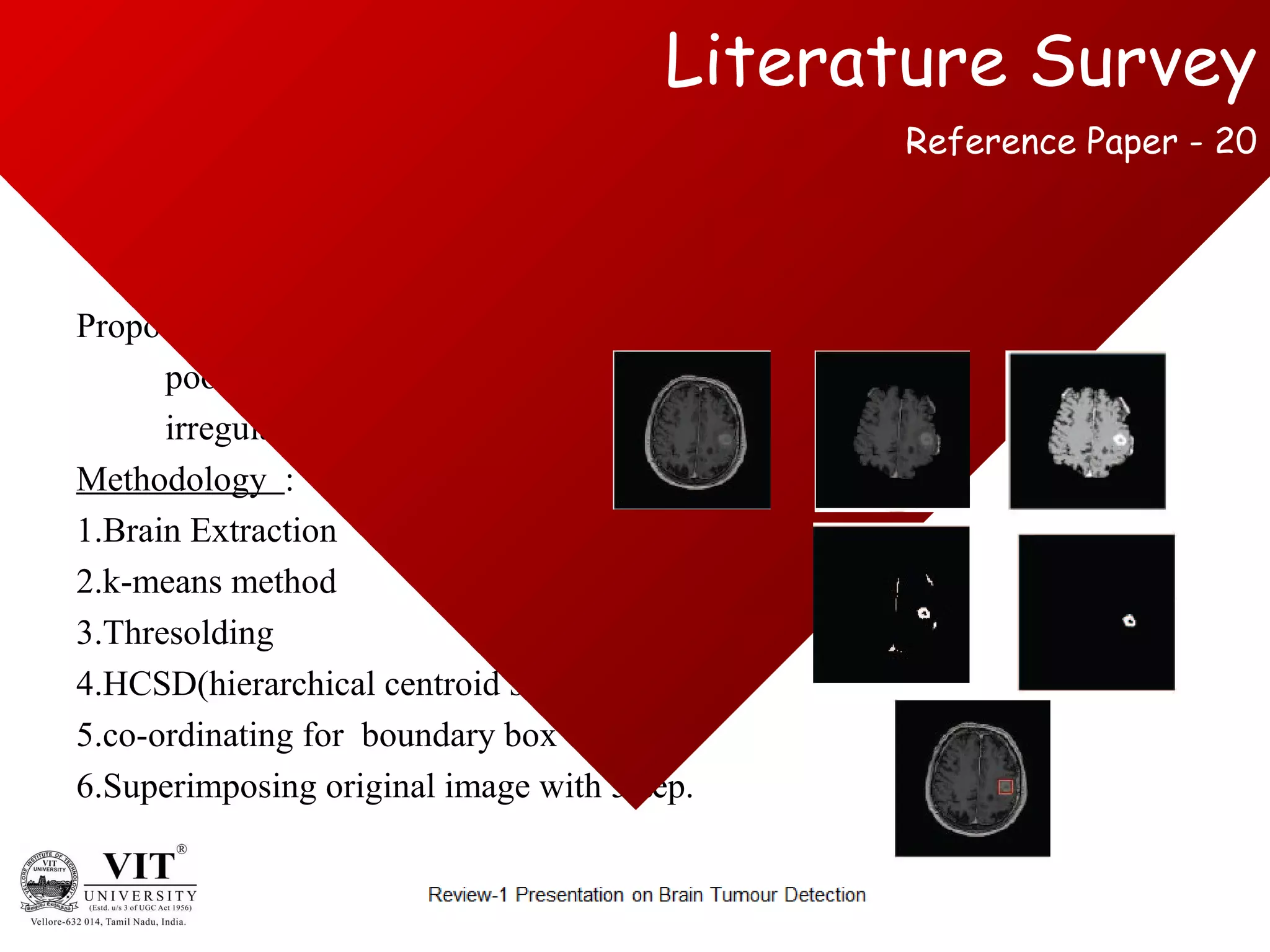 Brain Tumor Detection By Scanning Mri Images Using Filtering