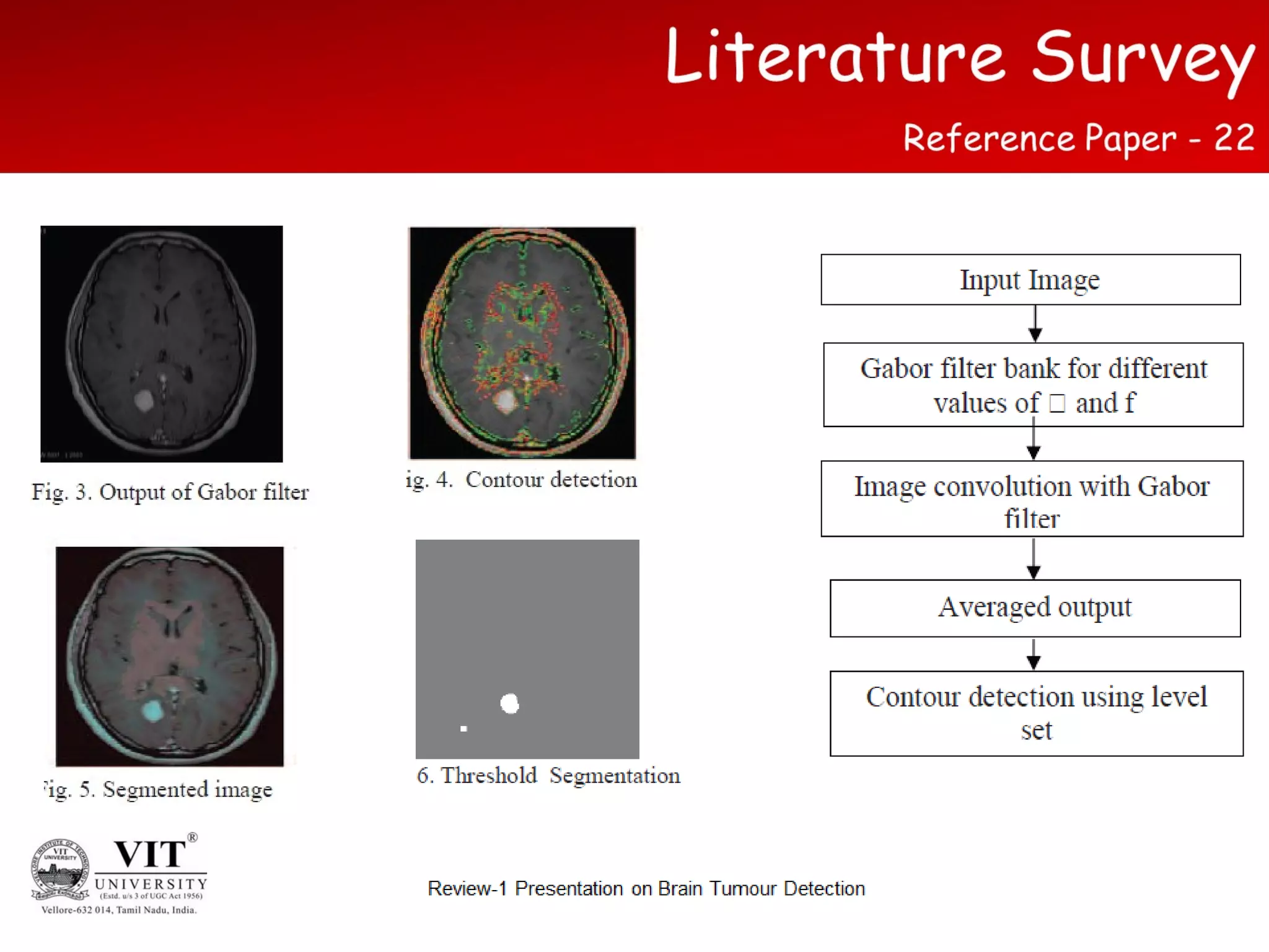 Brain Tumor Detection By Scanning Mri Images Using Filtering