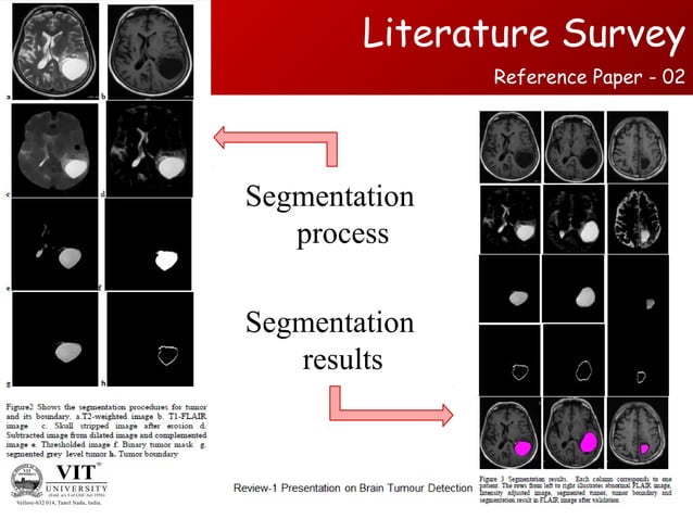 Brain Tumor Detection By Scanning Mri Images Using Filtering