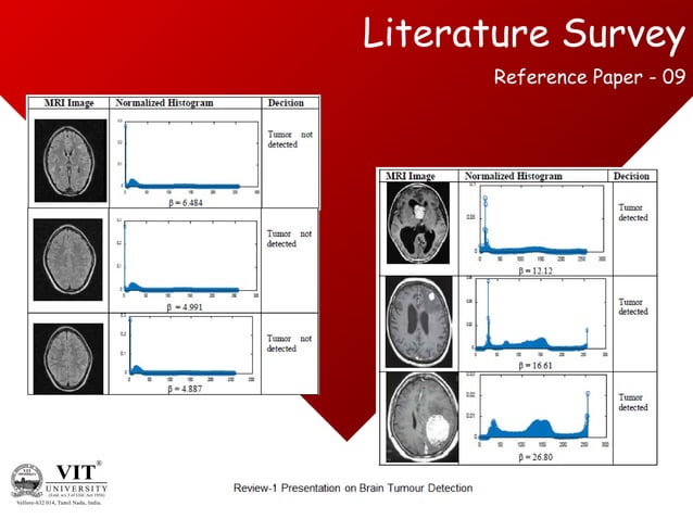 Brain Tumor Detection By Scanning Mri Images Using Filtering