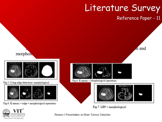 Brain Tumor Detection By Scanning Mri Images Using Filtering