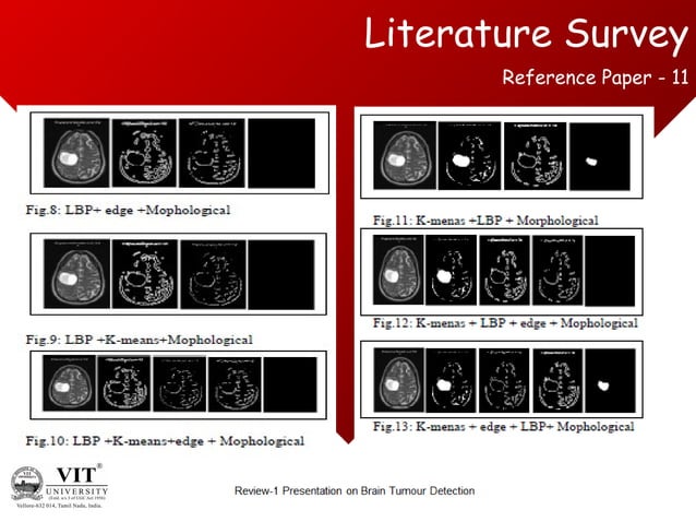 Brain Tumor Detection By Scanning Mri Images Using Filtering