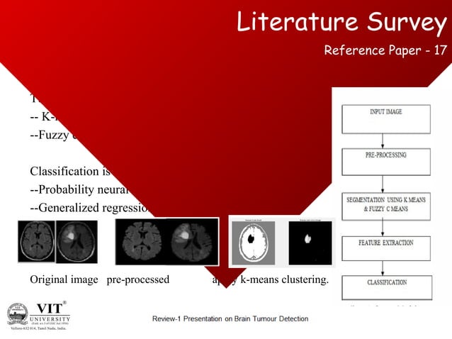 Brain Tumor Detection By Scanning Mri Images Using Filtering