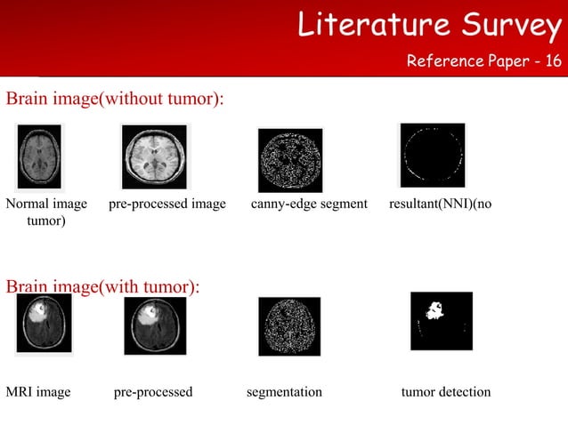 Brain tumor detection by scanning MRI images (using filtering techniques)