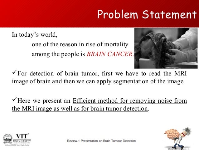 Brain Tumor Detection By Scanning Mri Images Using Filtering Techniq