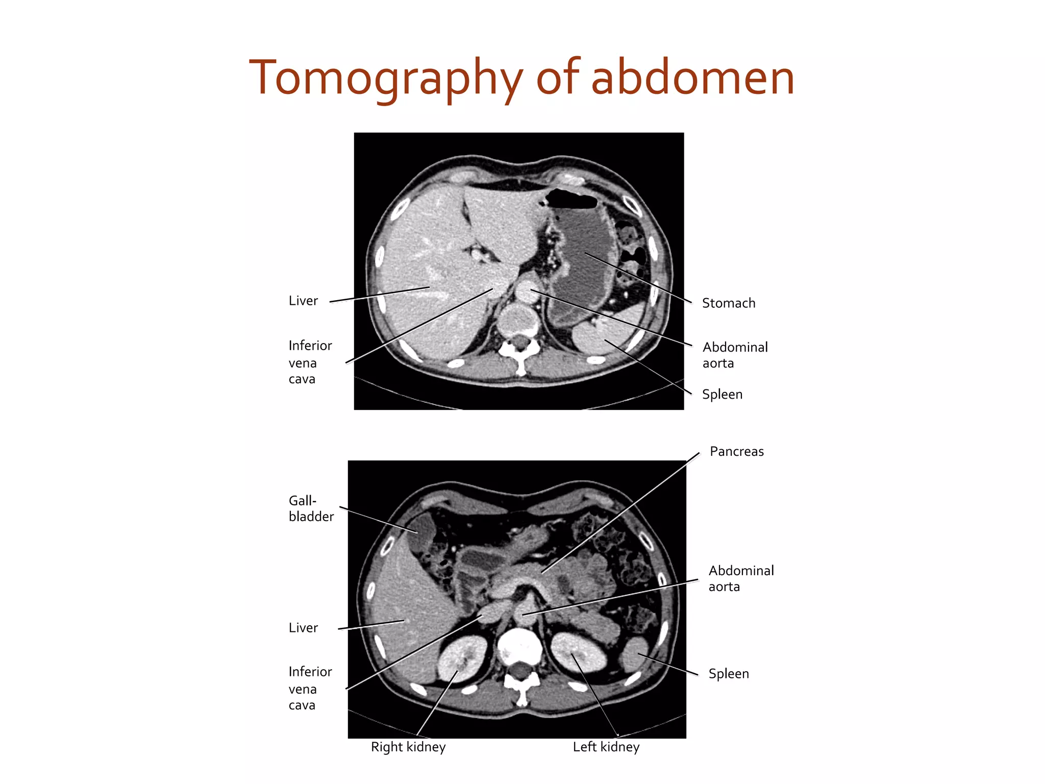 USMLE step 1 Review Anatomy of Gastrointestinal System 2018 | PDF